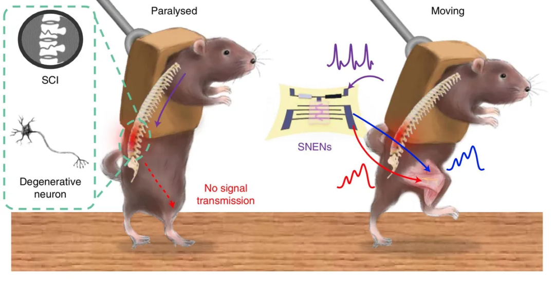 Artificial Nerves | The Ugly Minute