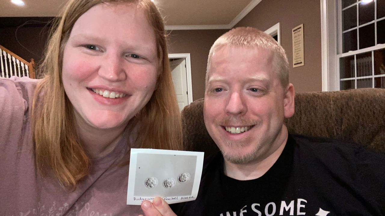 30 year old embryos born as Twins | The Ugly Minute